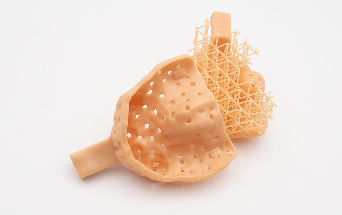 3D Printed Custom Impression Trays: Precision & Efficiency