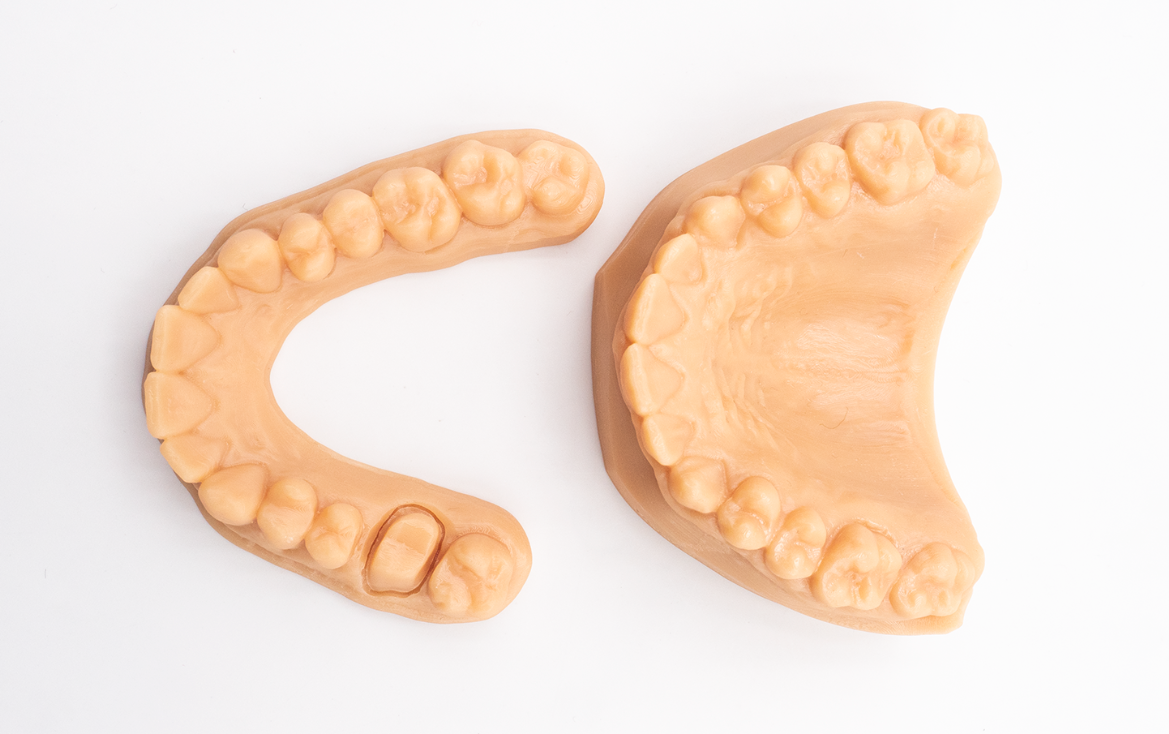 3D Printed Custom Impression Trays: Precision & Efficiency